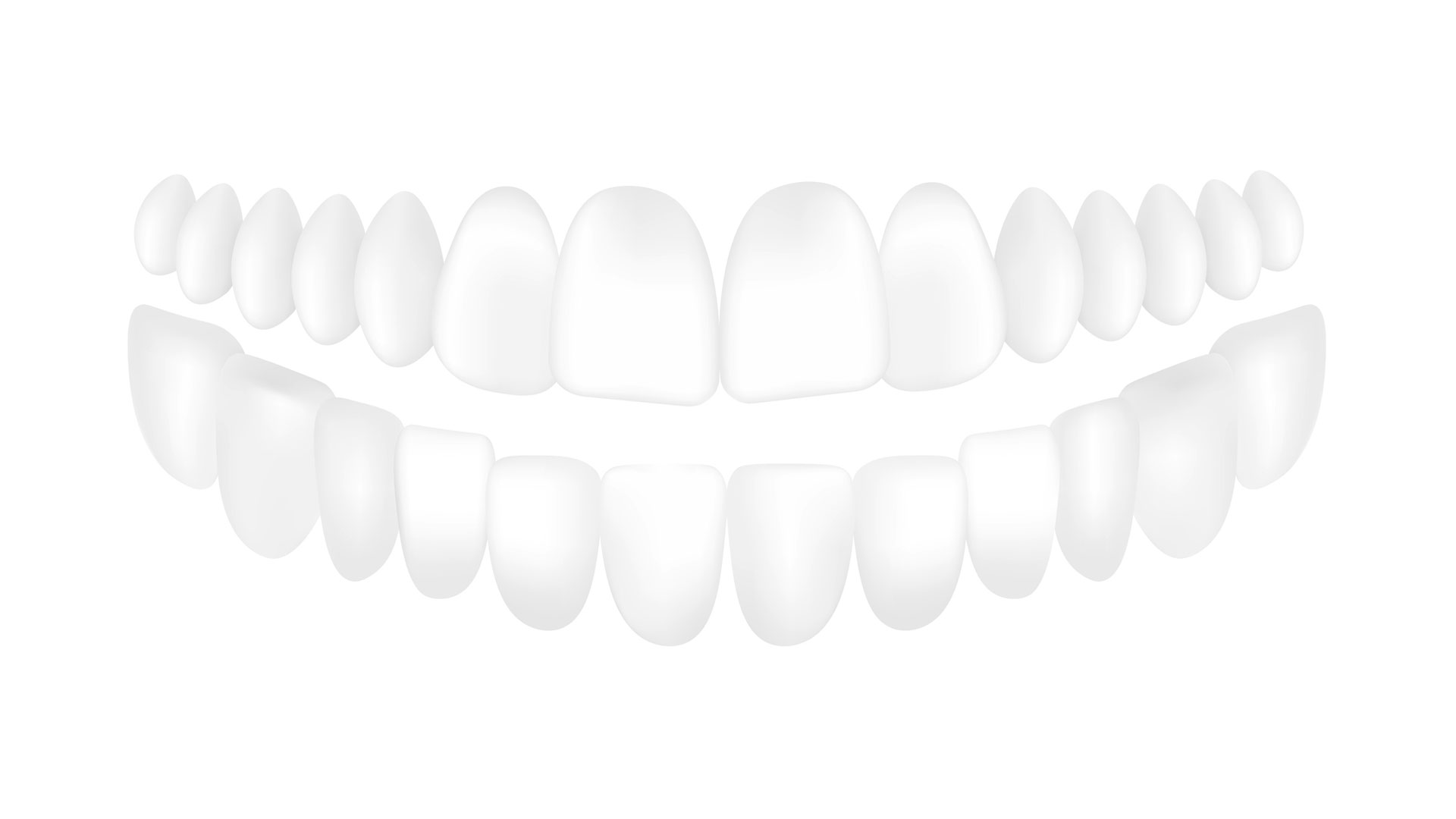 Prices Antalya Dent Smile prices-antalya-dent-smile