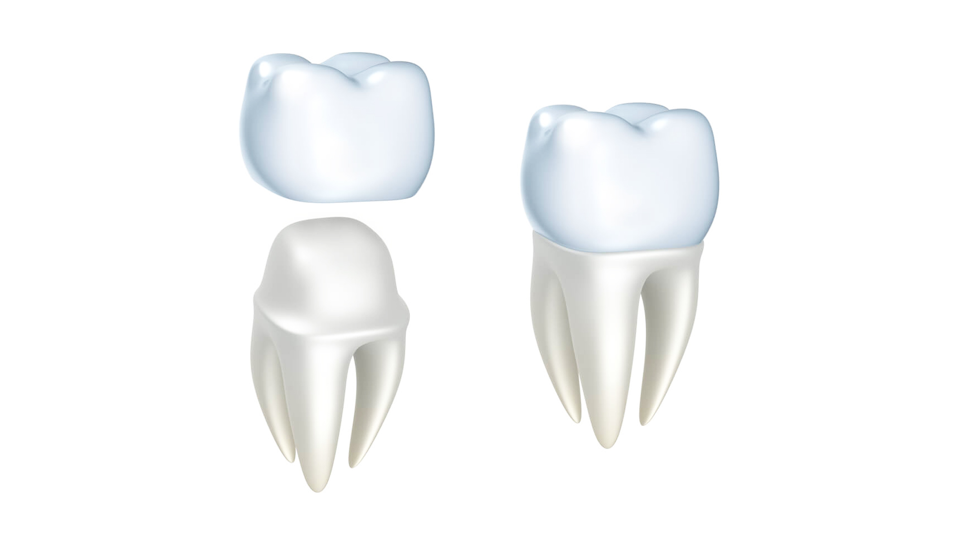 Zirconium Crowns: Procedure, Costs, Benefits and More - Antalya Dent Smile