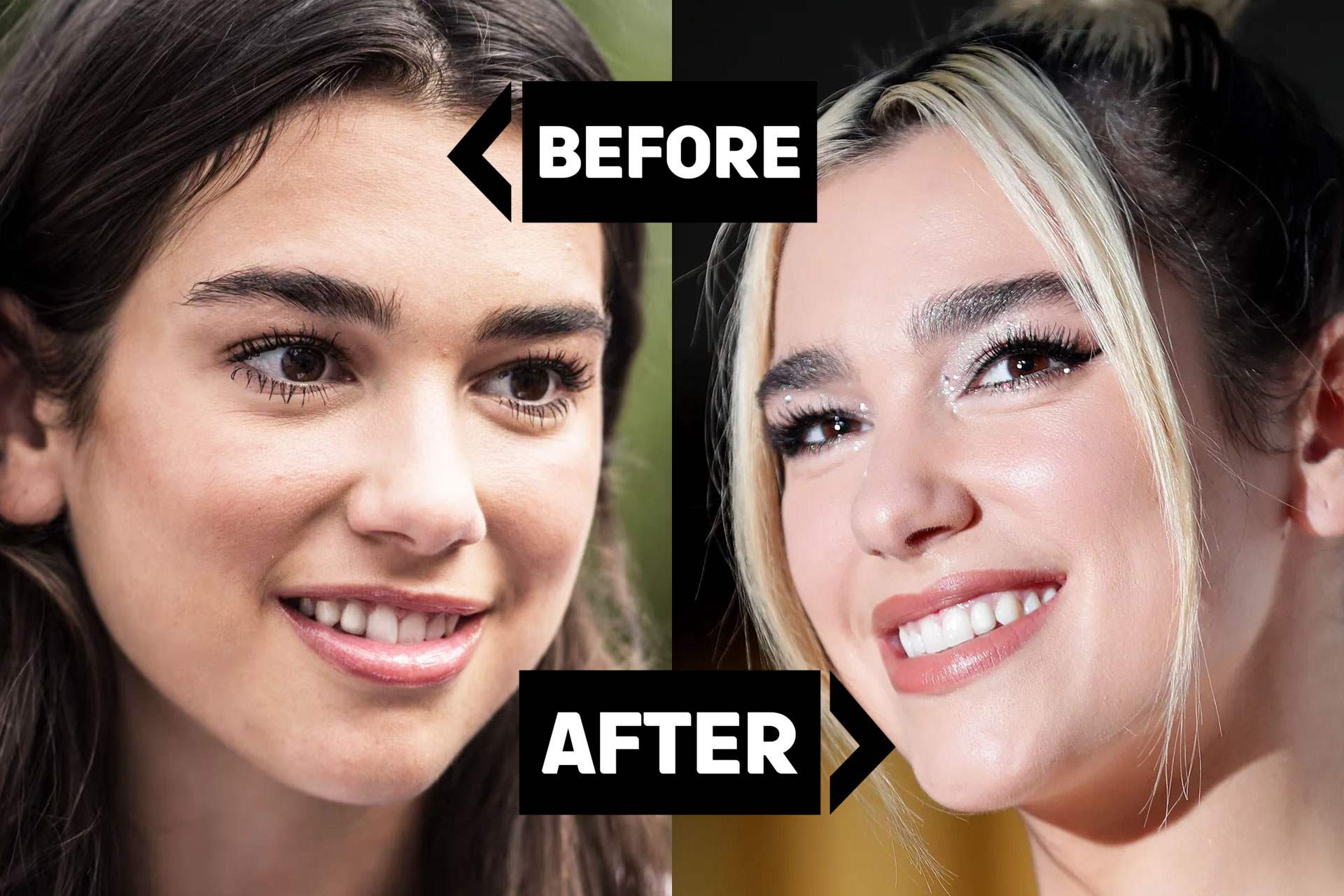 Selena Gomez Teeth Before And After