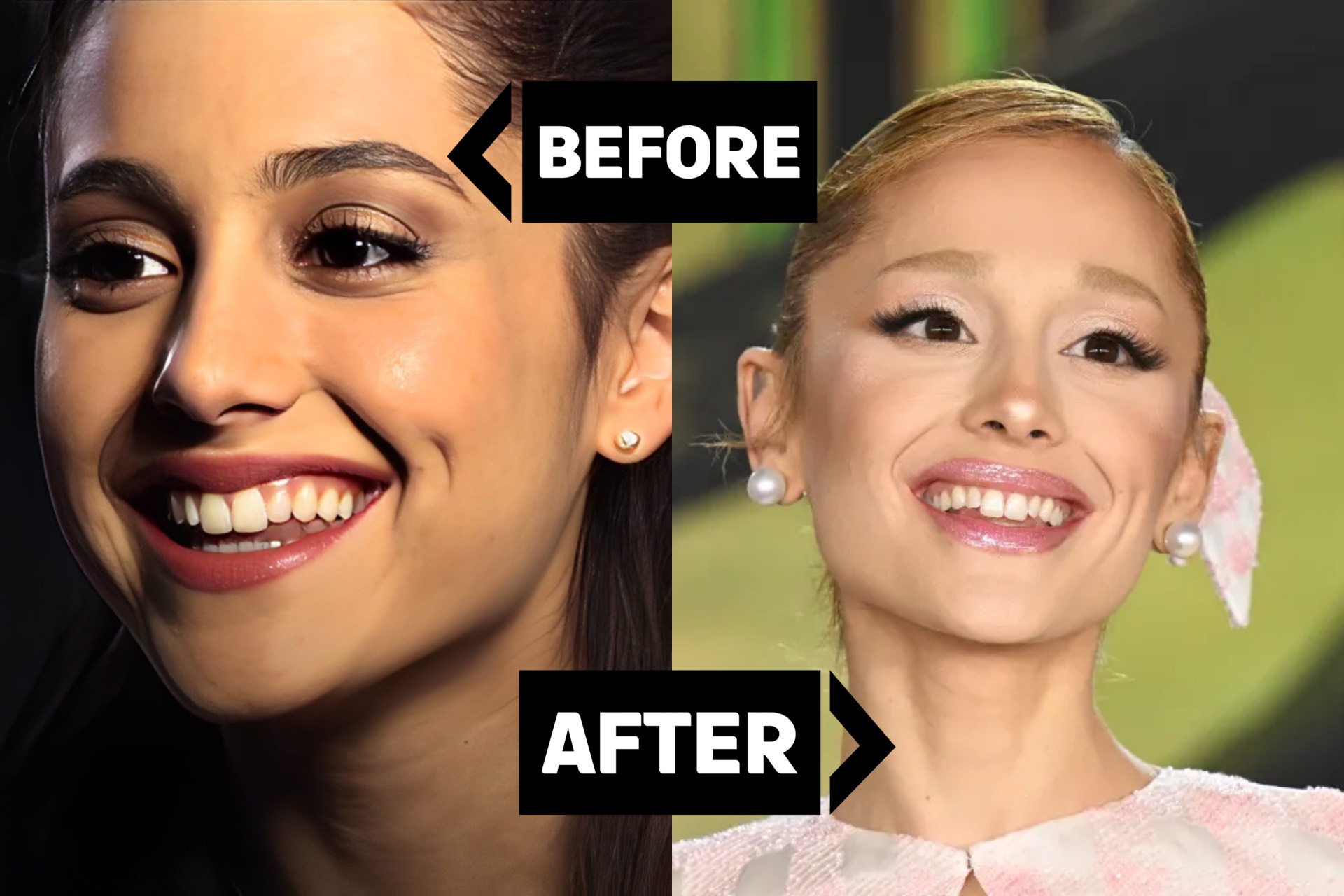 Ariana Grande's Naturally Beautiful Teeth - Antalya Dent Smile