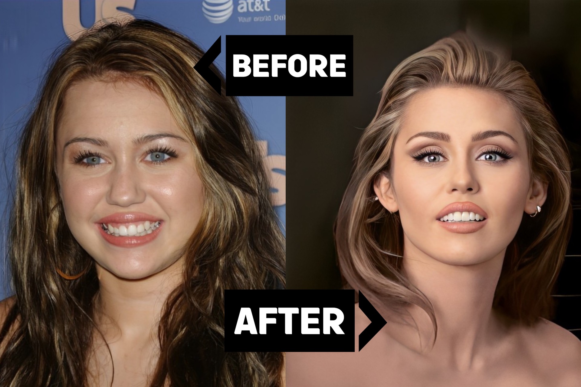 The Evolution of Miley Cyrus’ Aesthetic Smile - Antalya Dent Smile