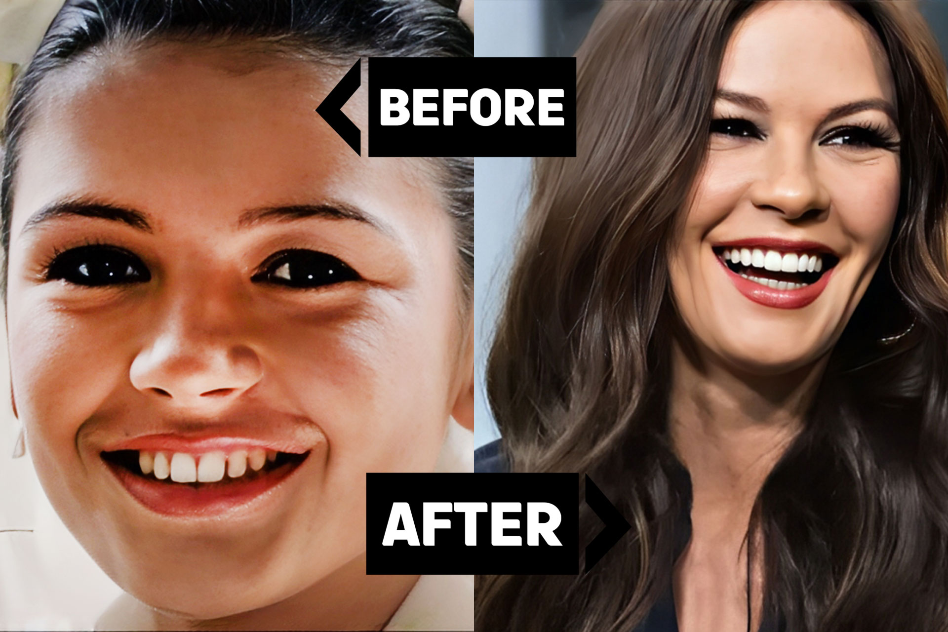 Story of Catherine Zeta-Jones' Dental Aesthetics and Her Smile That ...